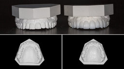 Veneer Prep School: Designing the Ideal Preparation