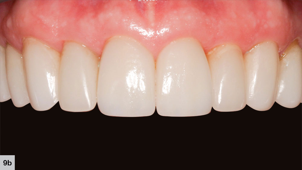 Cosmetic Dentistry: The Anatomy of a Natural Smile