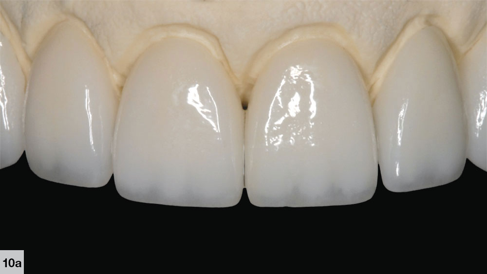 Cosmetic Dentistry: The Anatomy of a Natural Smile