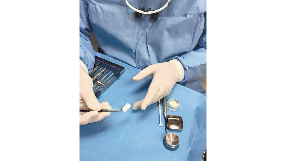 Extraction and Socket Grafting: Part 2 — Extraction Site Healing