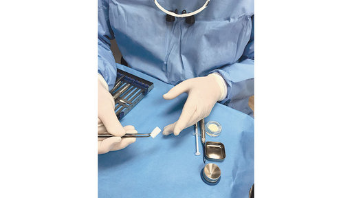 Extraction and Socket Grafting: Part 2 — Extraction Site Healing