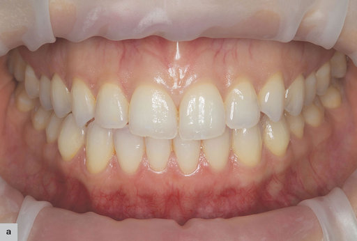 4 Simple Tips for Superb Dental Photographs