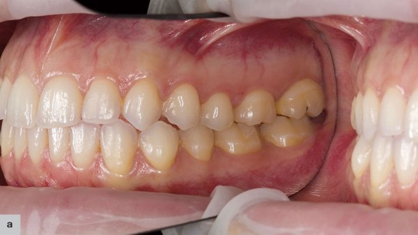 4 Simple Tips for Superb Dental Photographs