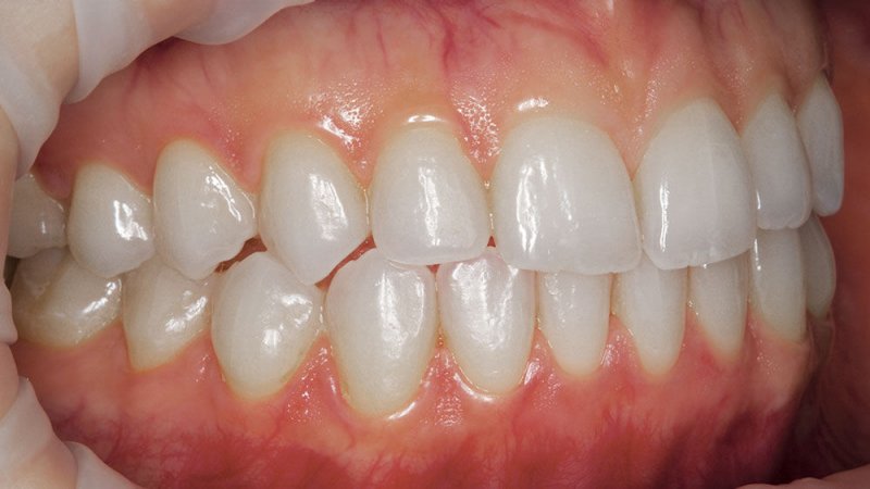 4 Simple Tips for Superb Dental Photographs