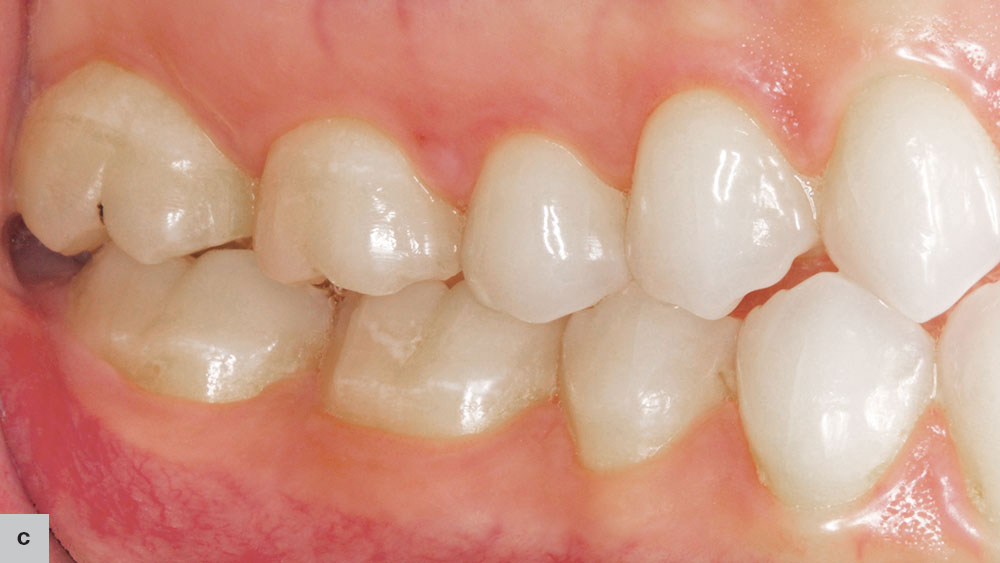 4 Simple Tips for Superb Dental Photographs
