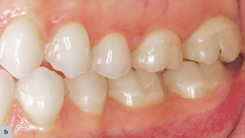 4 Simple Tips for Superb Dental Photographs