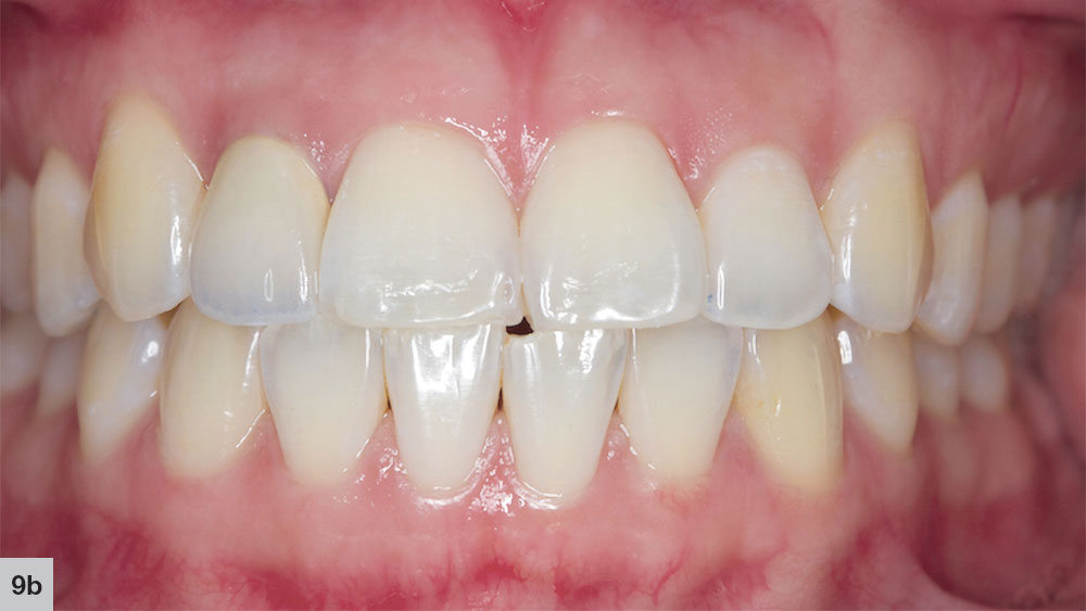 4 Simple Tips for Superb Dental Photographs