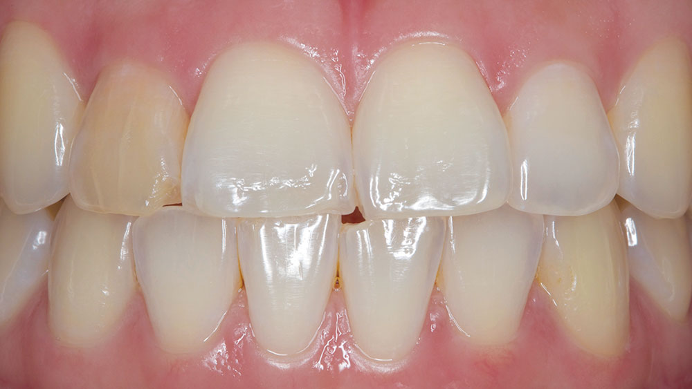 4 Simple Tips for Superb Dental Photographs