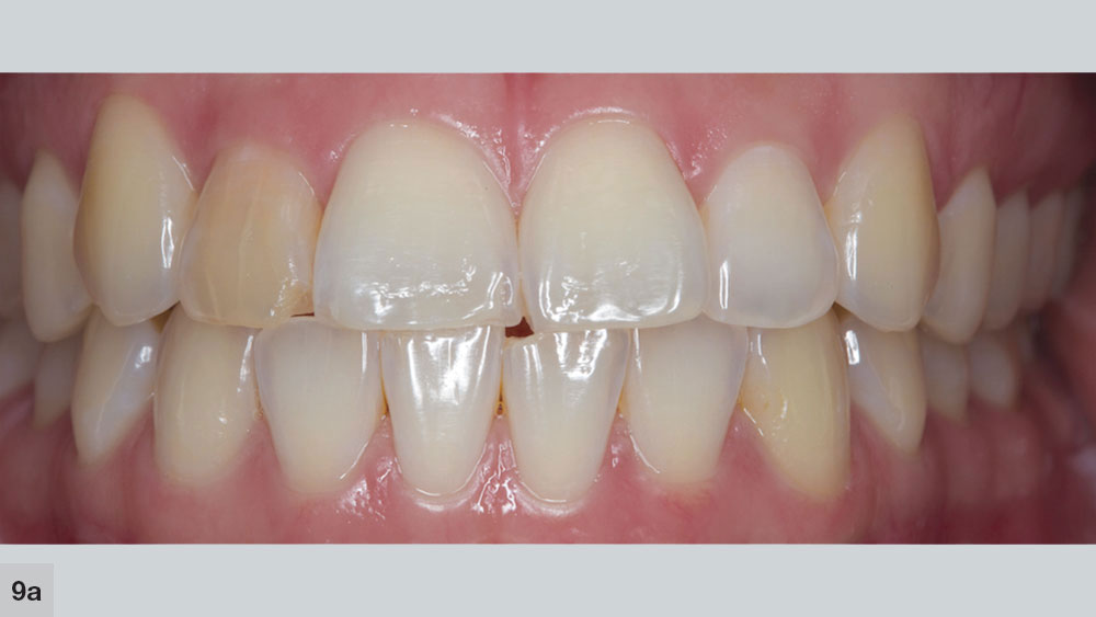 4 Simple Tips for Superb Dental Photographs