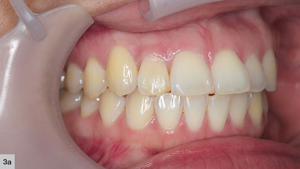 4 Simple Tips for Superb Dental Photographs