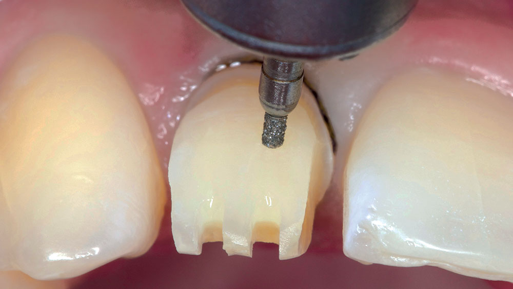 4 Simple Tips for Superb Dental Photographs