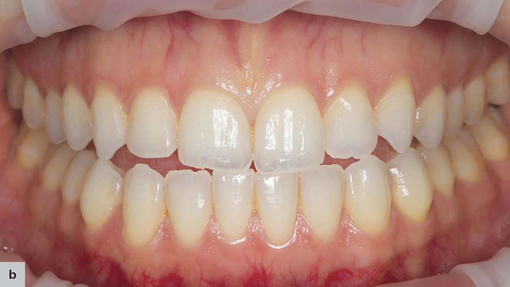 4 Simple Tips for Superb Dental Photographs