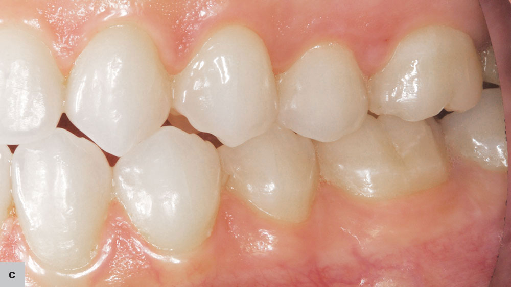 4 Simple Tips for Superb Dental Photographs