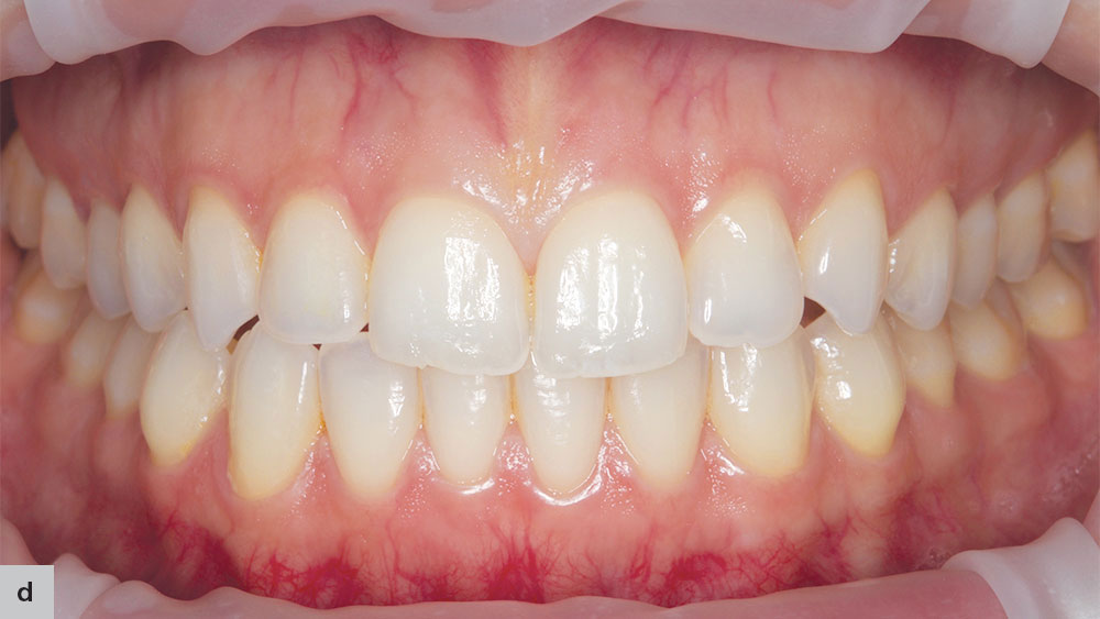 4 Simple Tips for Superb Dental Photographs