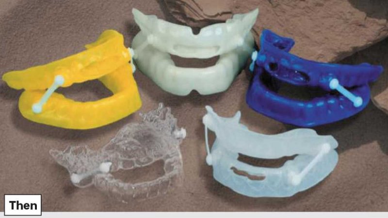 A New Lease on Life with the Silent Nite® Sleep Appliance: How Dentists Are Helping Patients ...