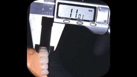 Using BioTemps Provisionals for Dental Case Acceptance