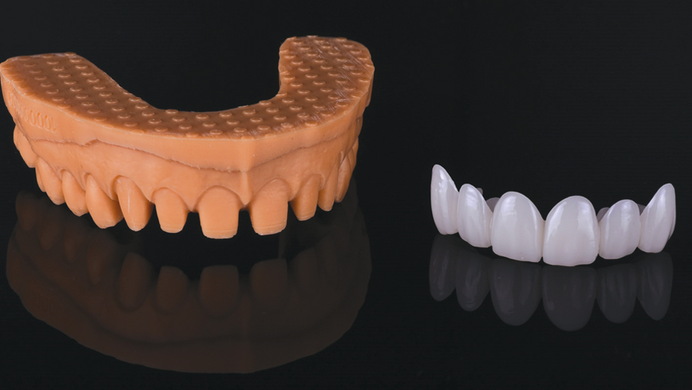 Using BioTemps Provisionals for Dental Case Acceptance