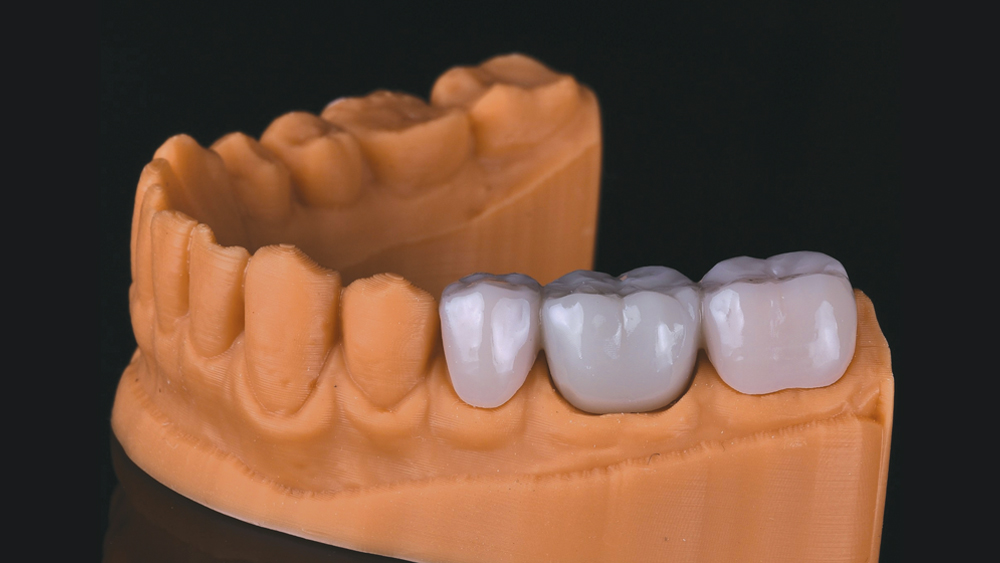 Using BioTemps Provisionals for Dental Case Acceptance