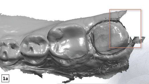 Digital Impressions: Common Problems and How to Avoid Them