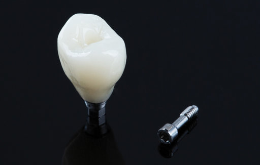 Immediate Implant Provisionalization: Four Ways | Glidewell