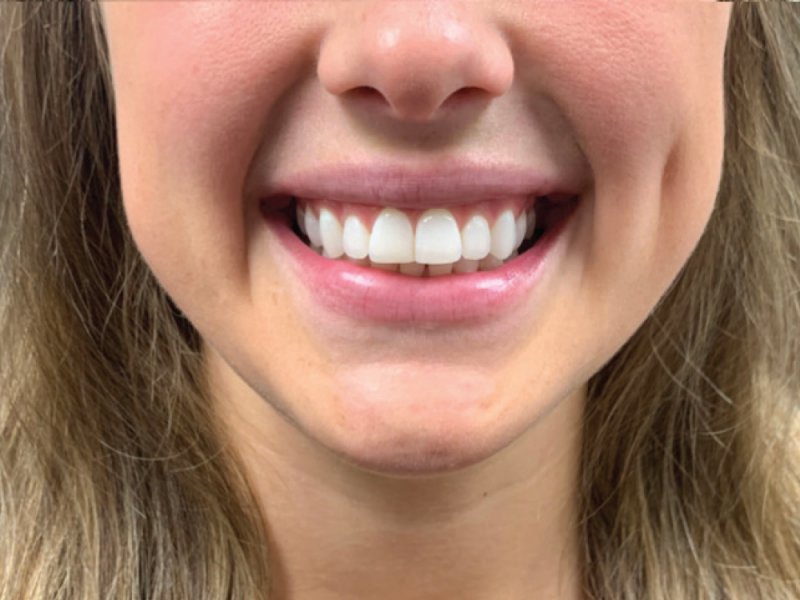 How did a private practitioner tripled practice production?