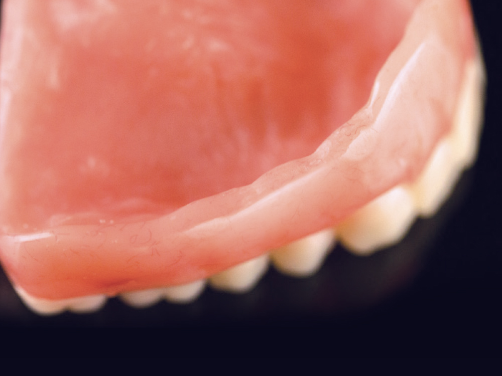 Complete Dentures: Troubleshooting Common Complaints