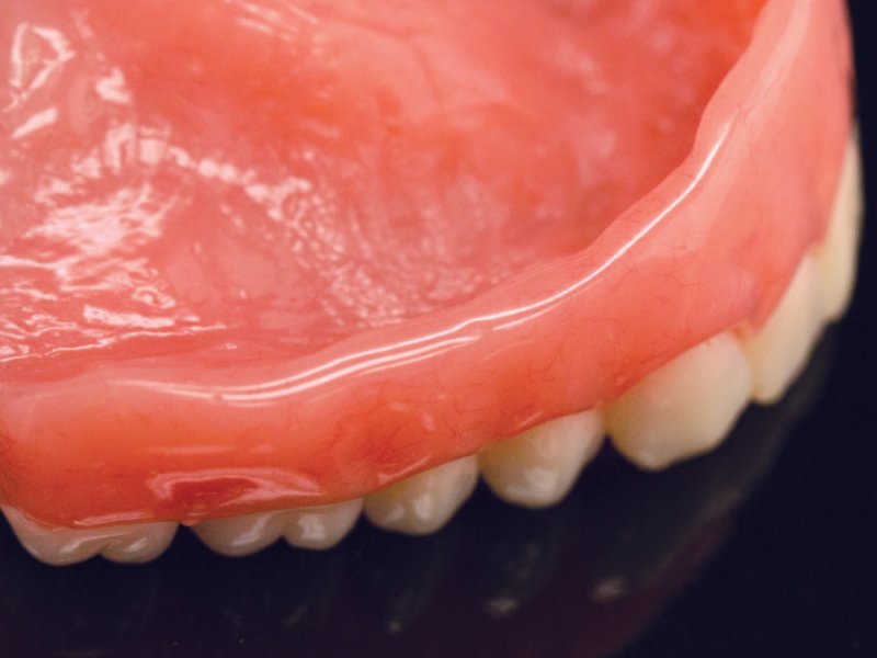 Complete Dentures: Troubleshooting Common Complaints
