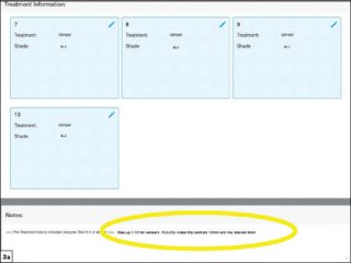 Benefits of a Diagnostic Wax-Up to Preview a Smile Makeover