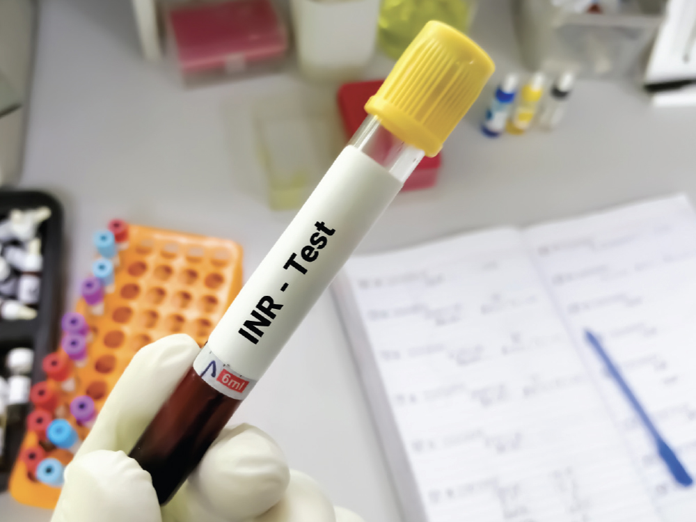 Randolph R. Resnik, DMD, MDS - Systemic Medication Influence