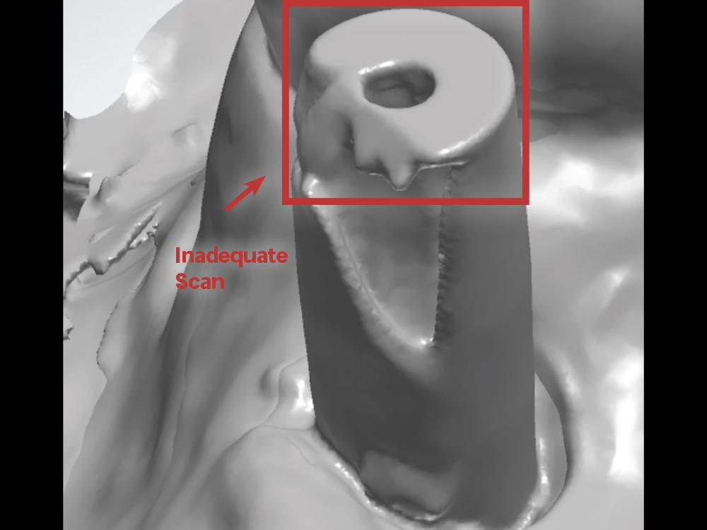 4 Steps to Capture Accurate Digital Dental Impressions