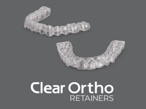 Choosing the Right Retainer for Your Patient