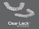 Choosing the Right Retainer for Your Patient