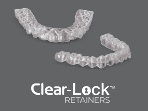 Choosing the Right Retainer for Your Patient