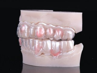Choosing the Right Retainer for Your Patient