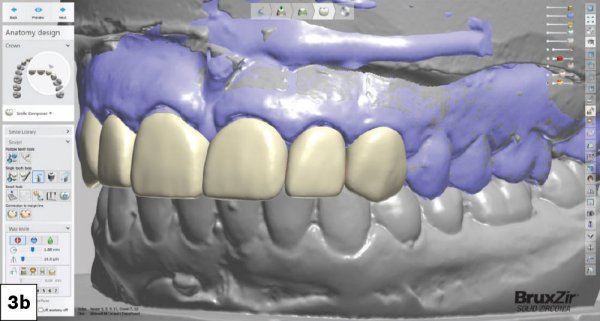 Creating a More Professional Smile | Case Study