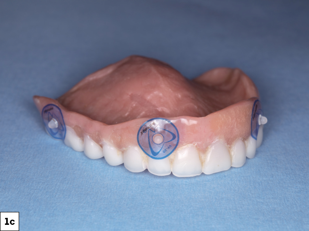 Multi-Level Surgical & Prosthetic Guide