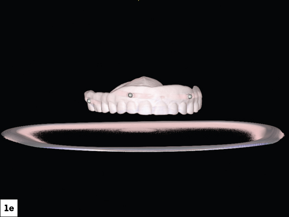 Multi-Level Surgical & Prosthetic Guide