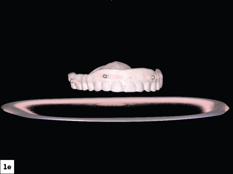 Multi-Level Surgical & Prosthetic Guide