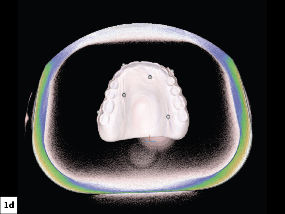 Multi-Level Surgical & Prosthetic Guide