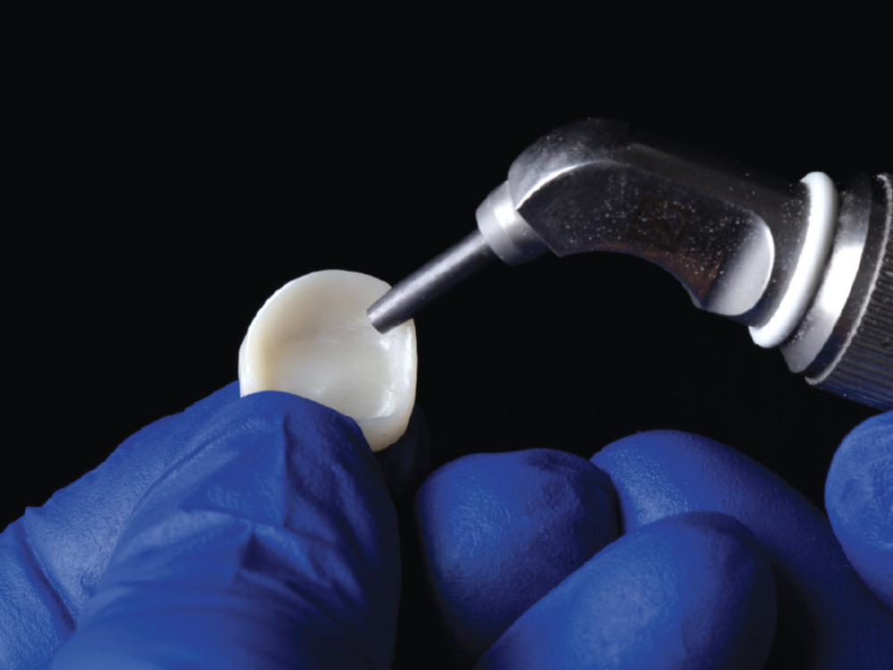 Cementation of Zirconia and Lithium Disilicate Restorations