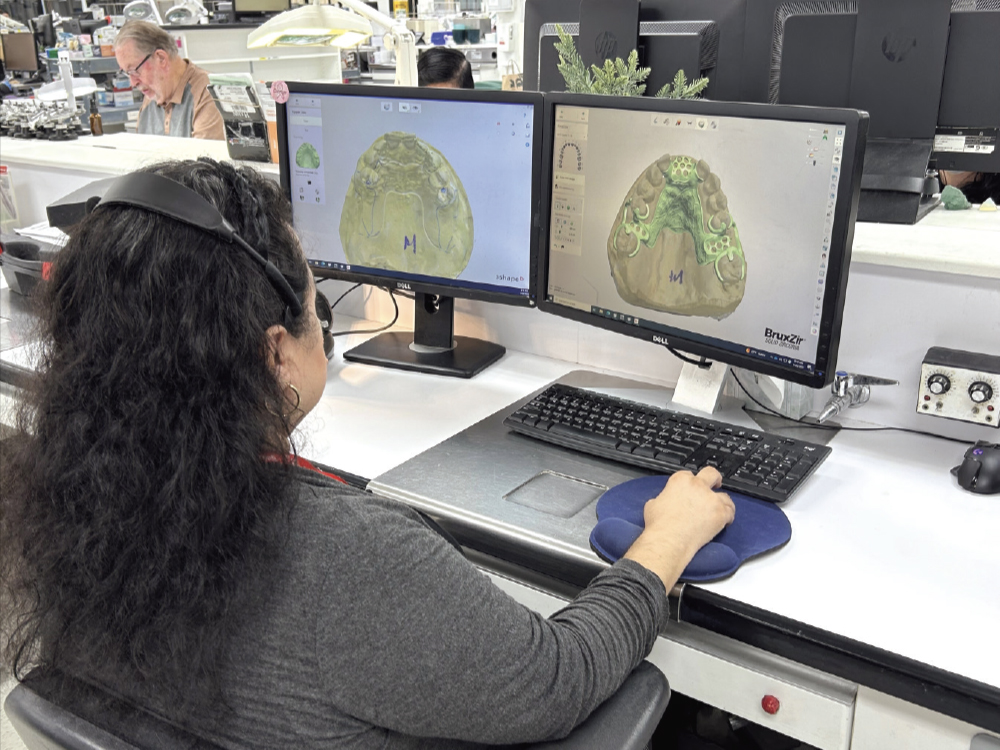 How to Produce Better-Fitting Partial Dentures