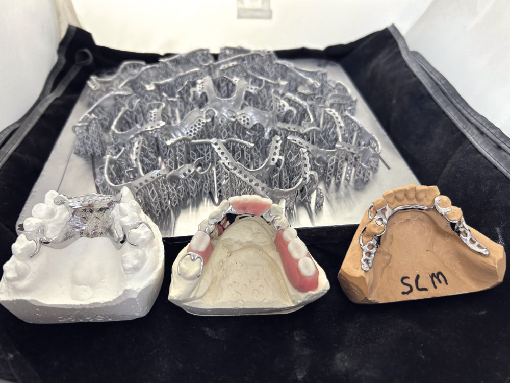 How to Produce Better-Fitting Partial Dentures