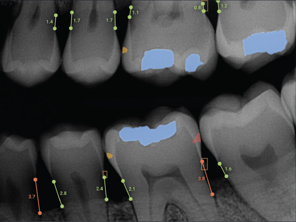 Bringing AI Into the Forefront of X-ray Analysis