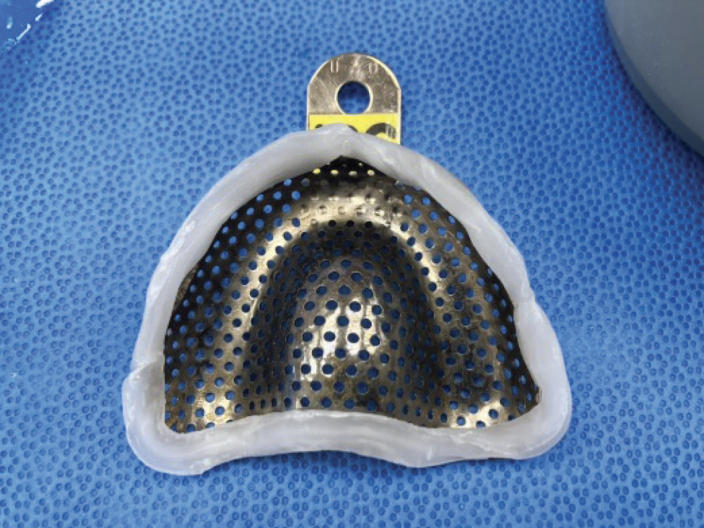 Dental Impression Materials & Approach for Complete Dentures