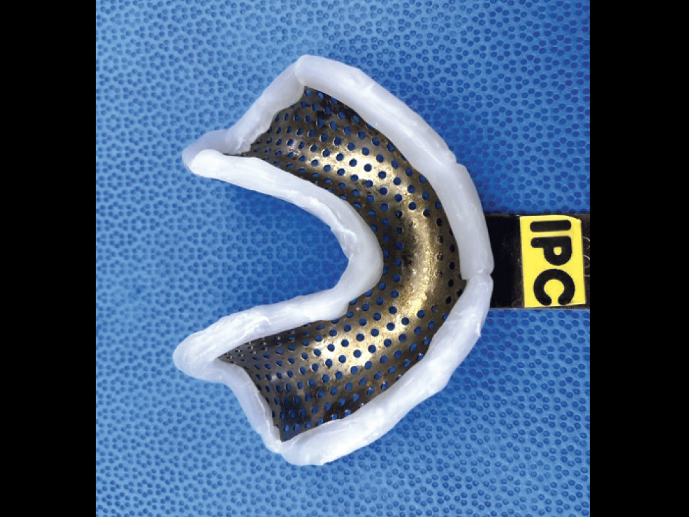 Dental Impression Materials & Approach for Complete Dentures