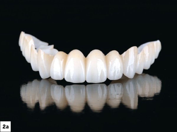 Test-Drive Future Treatment with Smile Transitions™