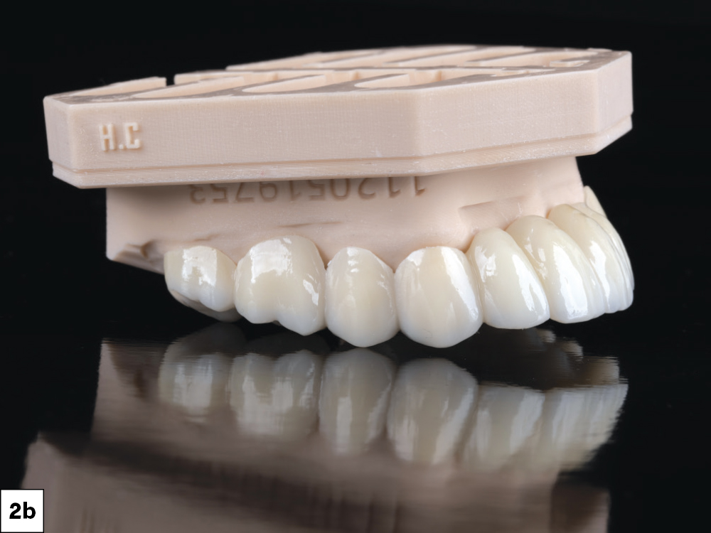 Test-Drive Future Treatment with Smile Transitions™