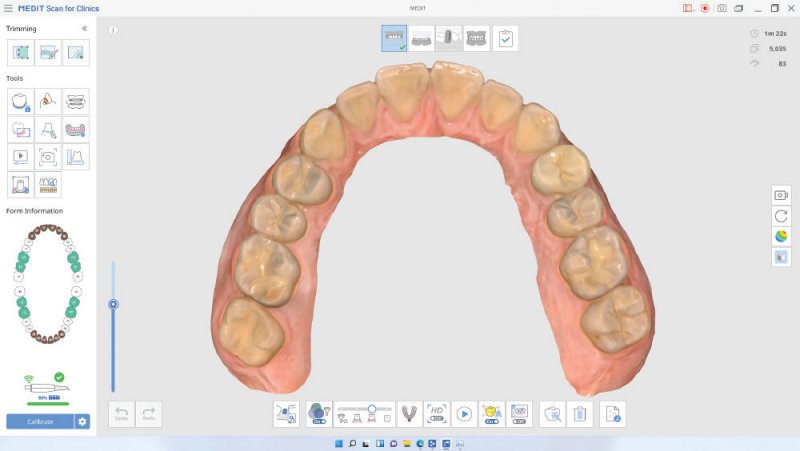 The fastscan.io™ Scanning Solution | Same-visit Restorations