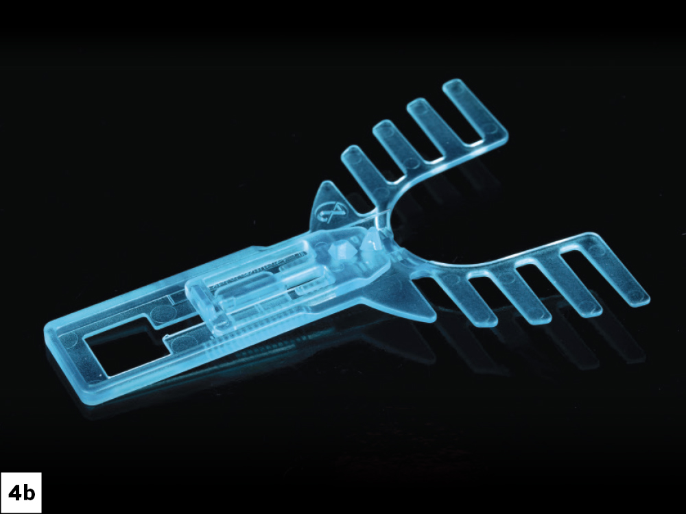 Silent Nite® 3D Sleep Appliance: Case Report