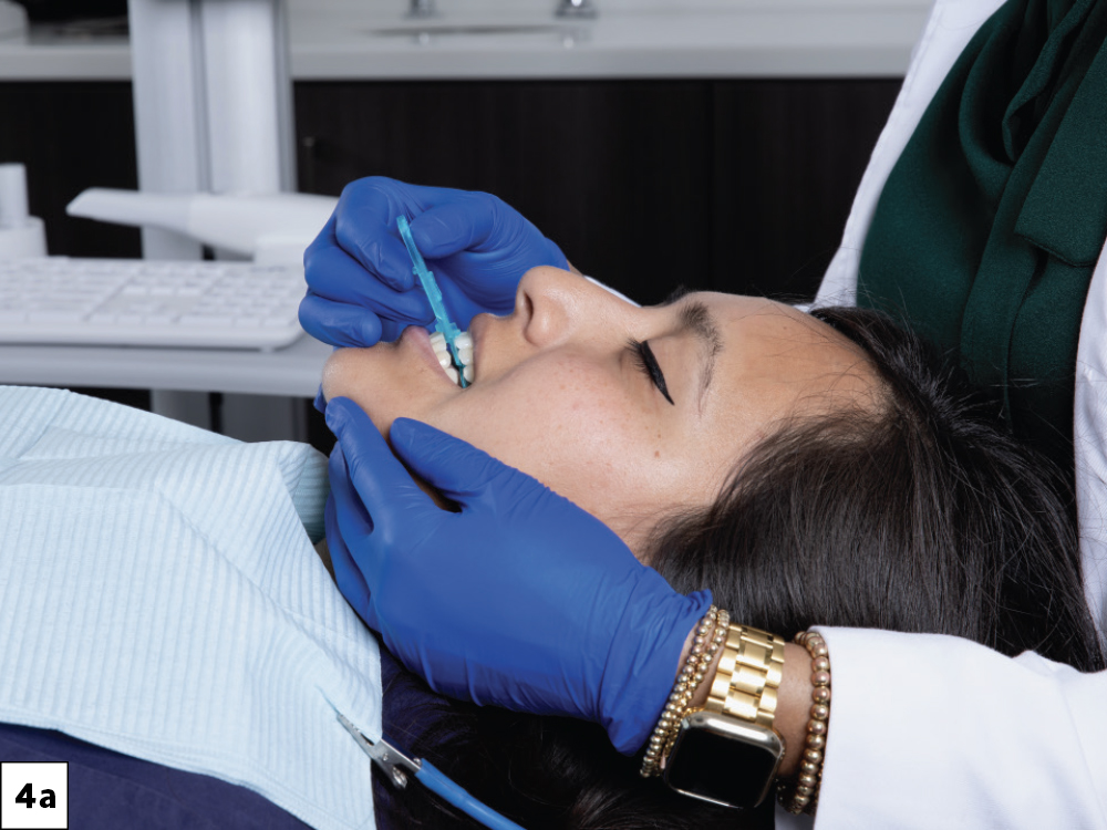 Silent Nite® 3D Sleep Appliance: Case Report